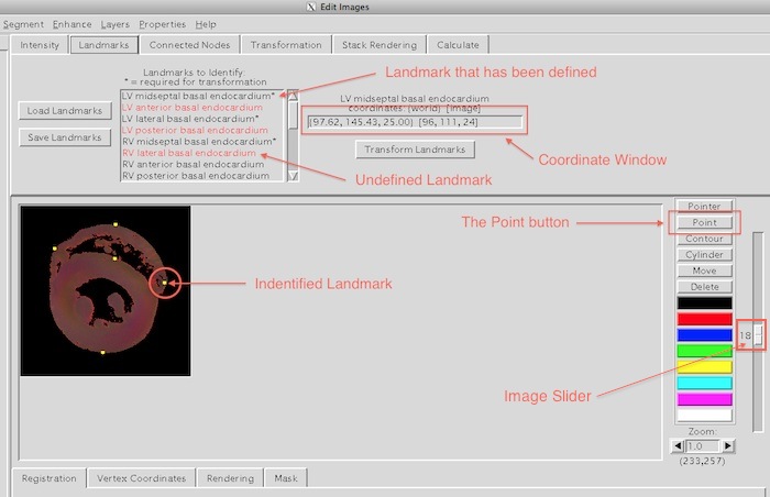 Image Landmarks – Continuity